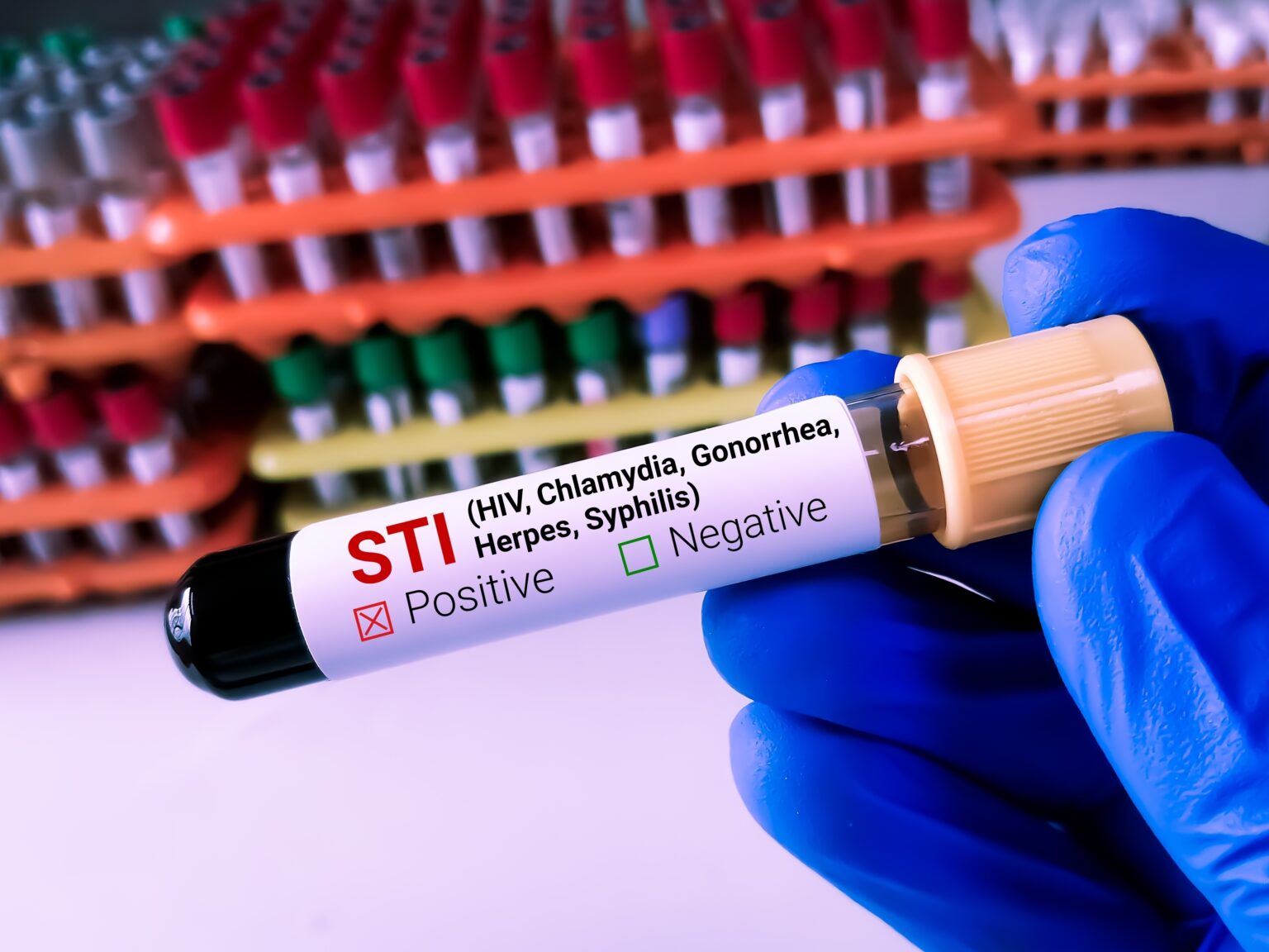 Why STD Testing is Essential | Prevent Spreading