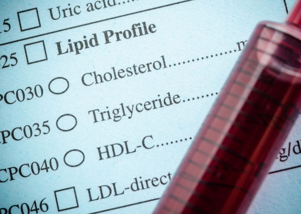 Low Cholesterol Causes, Symptoms & Care | +MEDRITE