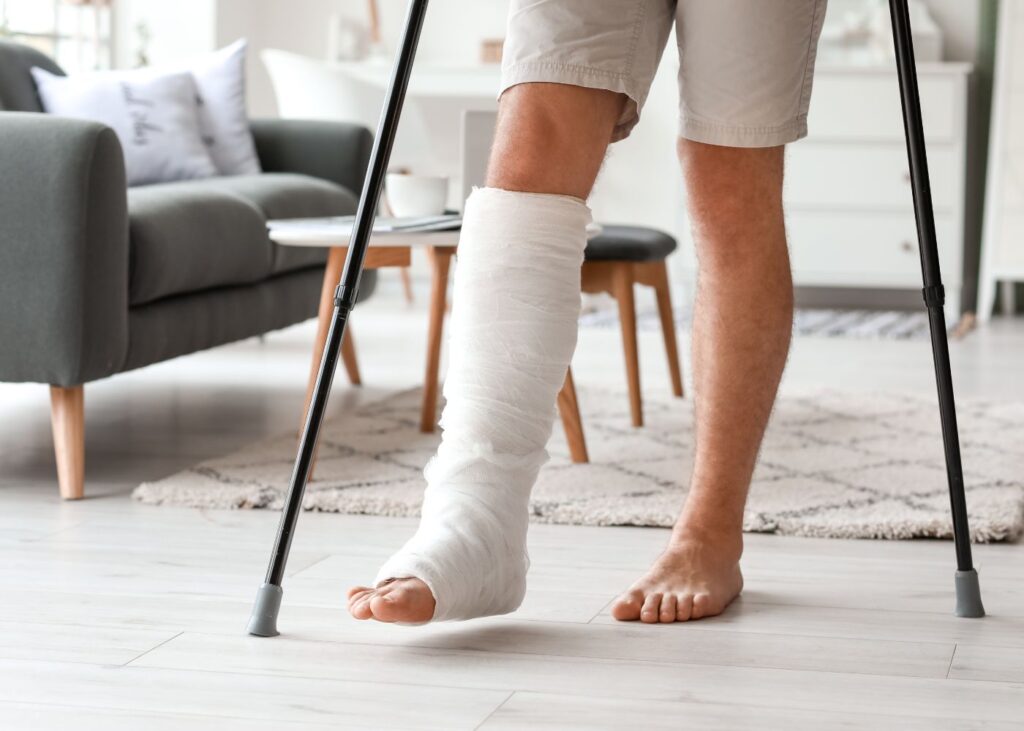 How Bones Heal: Guide to the Bone Healing Process