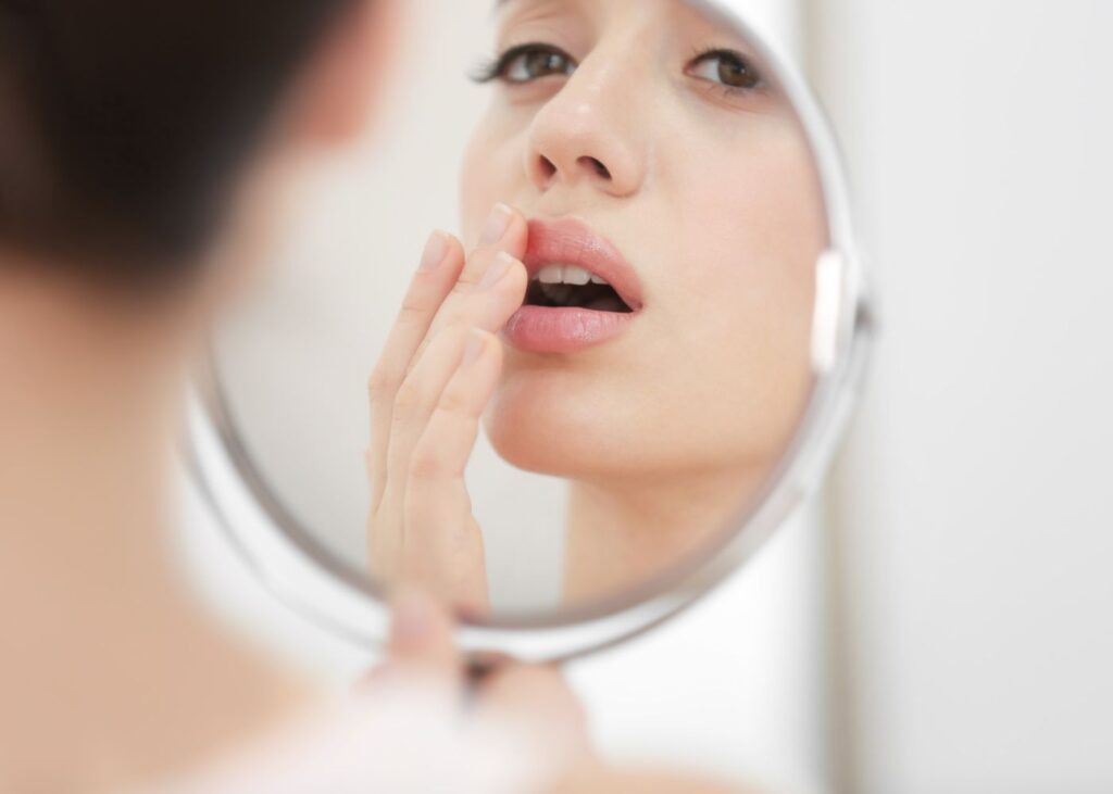 Cold Sores in Winter: Causes, Triggers, and Care | +MEDRITE